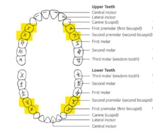 Bicuspid Teeth: Everything You Need to Know - Web DMD