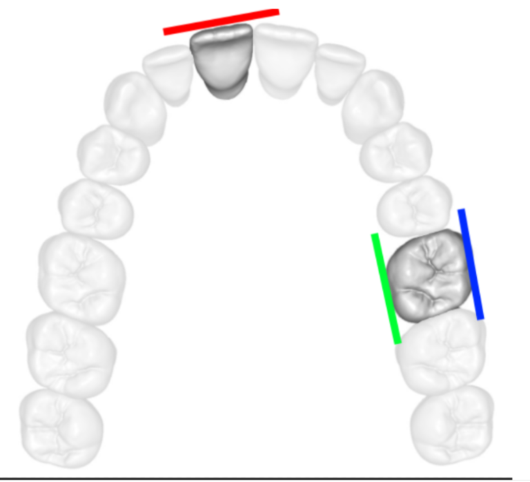 Teeth Surfaces: Dental Terminology - Web DMD