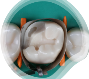 Teeth Surfaces: Dental Terminology - Web DMD