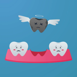 Can Wisdom Teeth Fall Out Naturally? - Web DMD