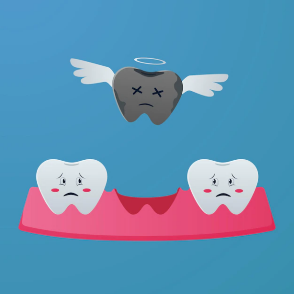 Can Wisdom Teeth Fall Out Naturally? - Web DMD