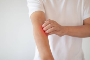 Surprising Causes of an Itchy Roof of Mouth - Web DMD