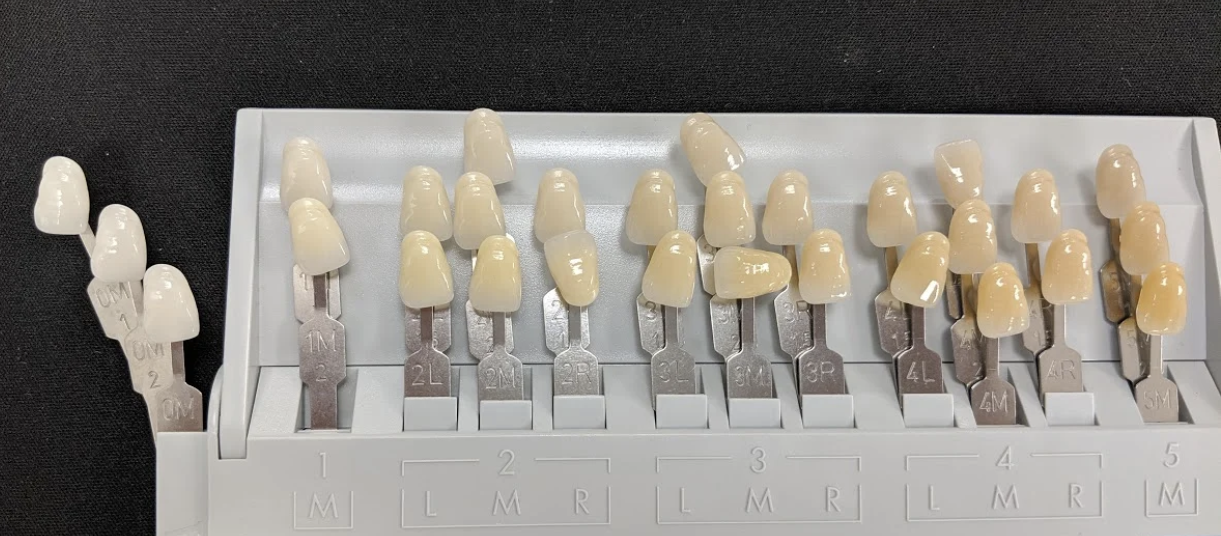 Dental Veneers: Complete Guide - Web DMD