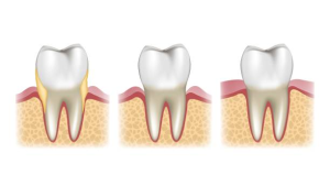 How to Floss Properly - Web DMD