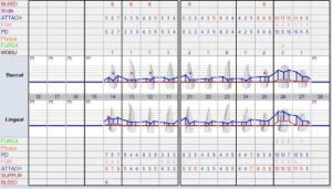 Periodontal Probing: Full Guide - Web DMD
