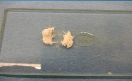 Temporary Tooth Fillings - Web DMD