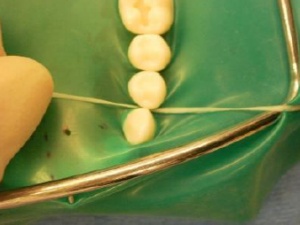 Rubber Dam for Dental Treatments - Web DMD