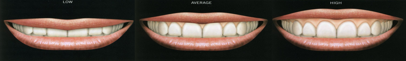 11+ Scientifically Proven Qualities of Beautiful Smiles - Web DMD