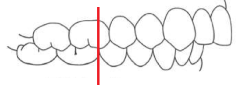 Dental Occlusion: How Your Teeth Fit Together - Web DMD