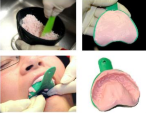 Dental Alginate Impressions - Web DMD