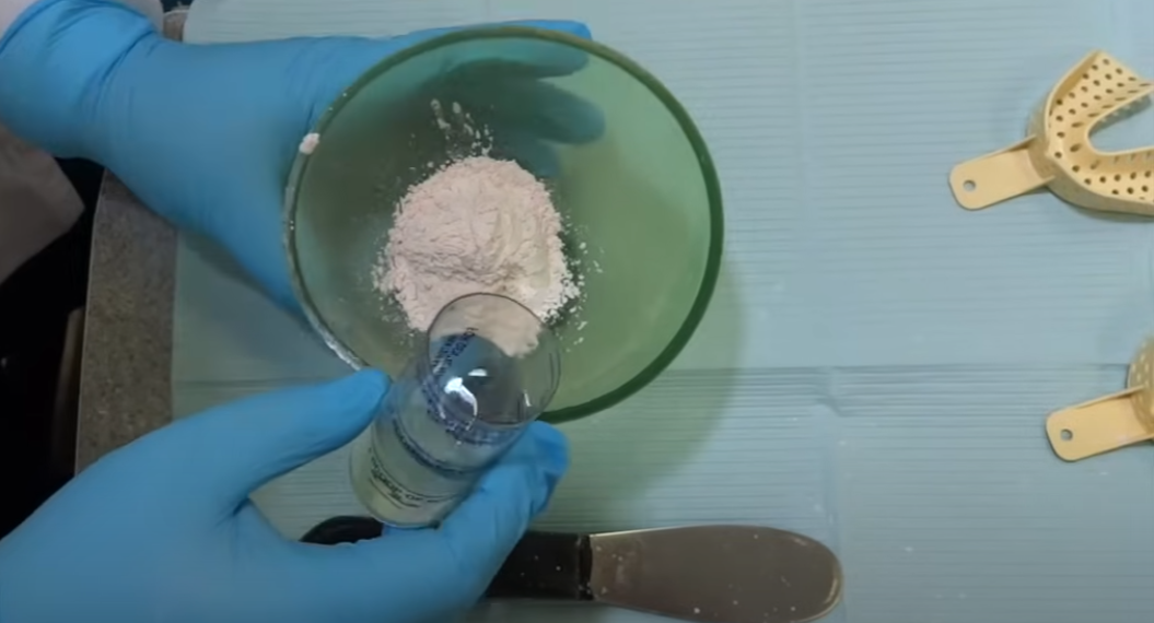 Dental Alginate Impressions - Web DMD