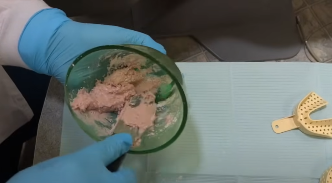 Dental Impressions - Web DMD