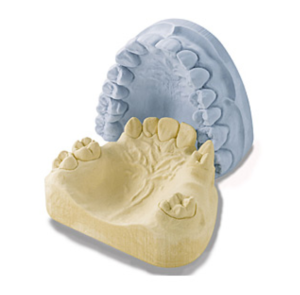 Dental Impressions - Web DMD