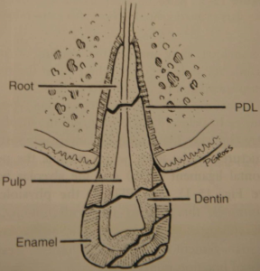 Understanding Tooth Trauma - Web DMD