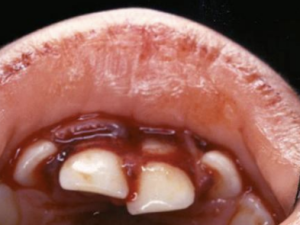 Understanding Tooth Trauma - Web DMD