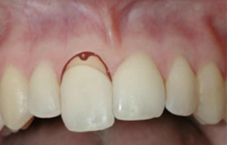 Understanding Tooth Trauma - Web DMD