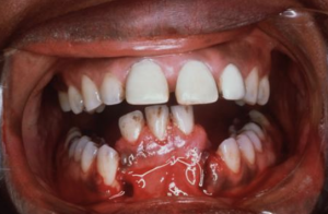 Understanding Tooth Trauma - Web DMD
