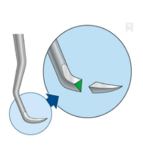 Dental Scaling: Preventing Dental Problems - Web DMD